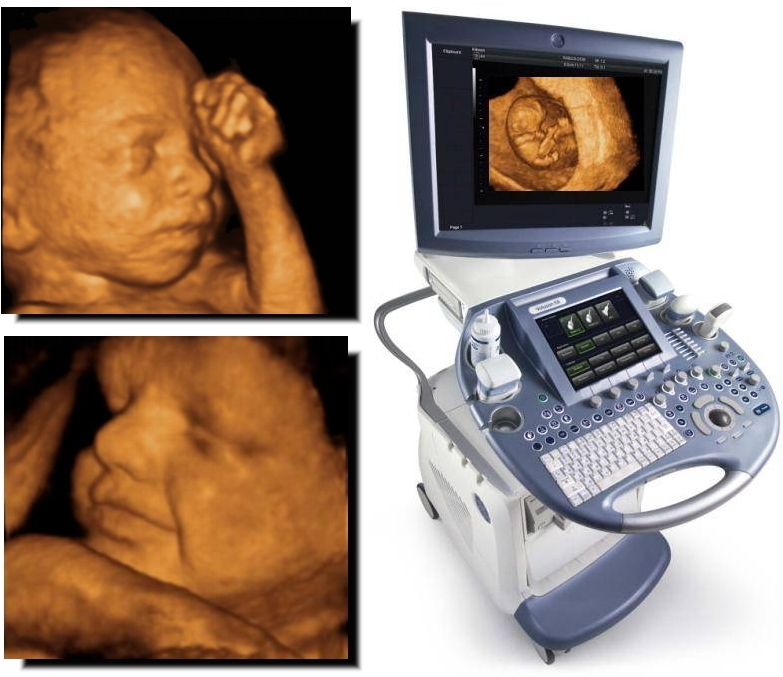 3D 4D Scan 3D 4D Scan