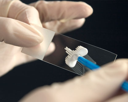 Cervical Screening Smear Test | Δρ Αθανάσιος Β. Μουσιώλης